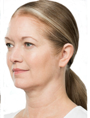 Fat Dissolving Chin Treatment - Parramatta and Hills District